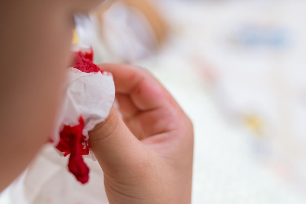 What you need to know about nosebleeds | Texas Children's